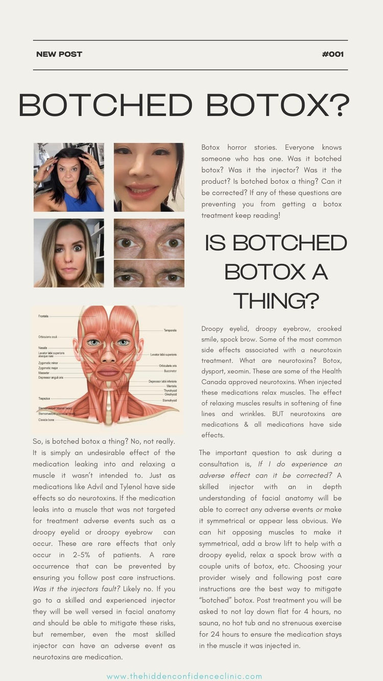 Botched Botox? – The Hidden Confidence Clinic