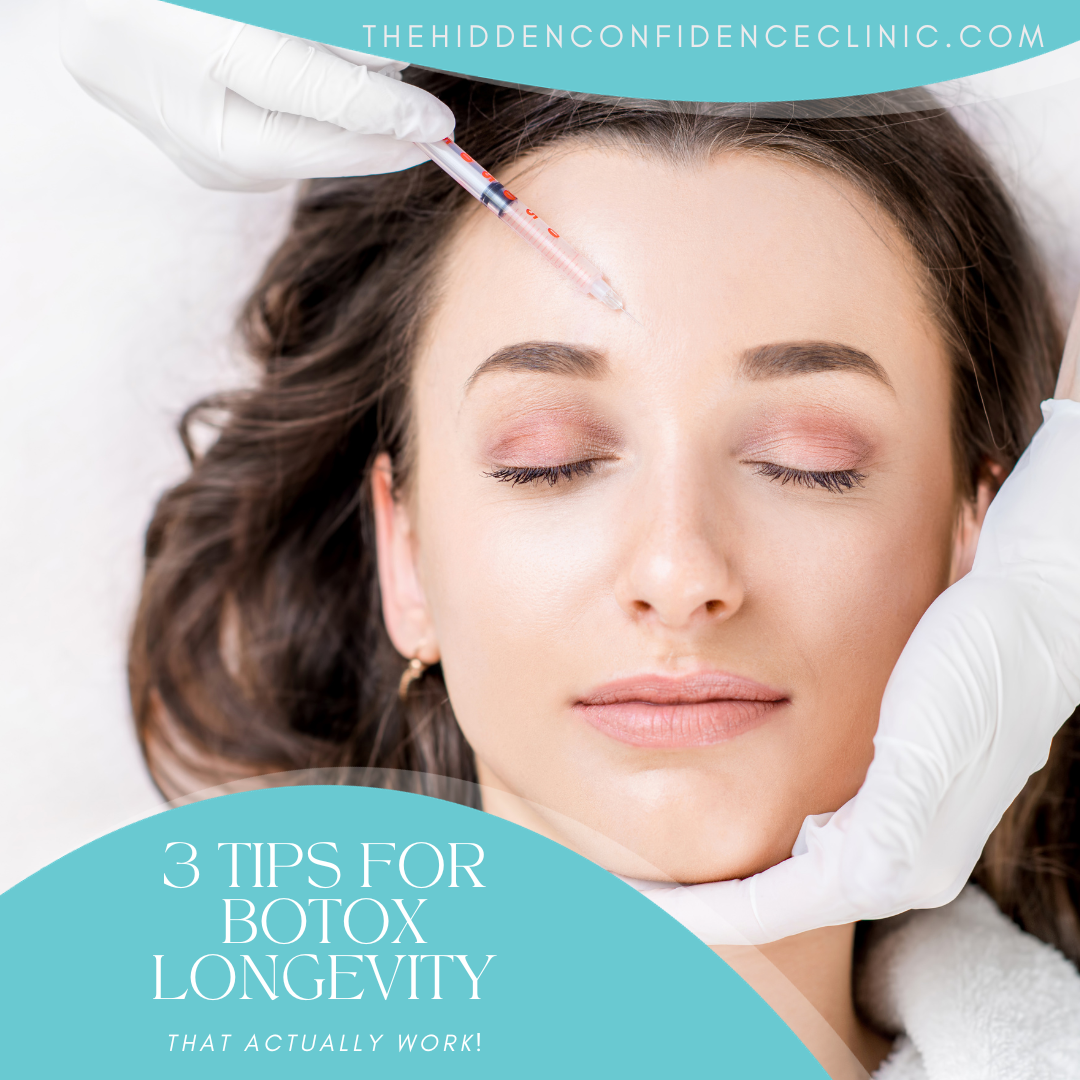 3 Tips For Botox Longevity – The Hidden Confidence Clinic